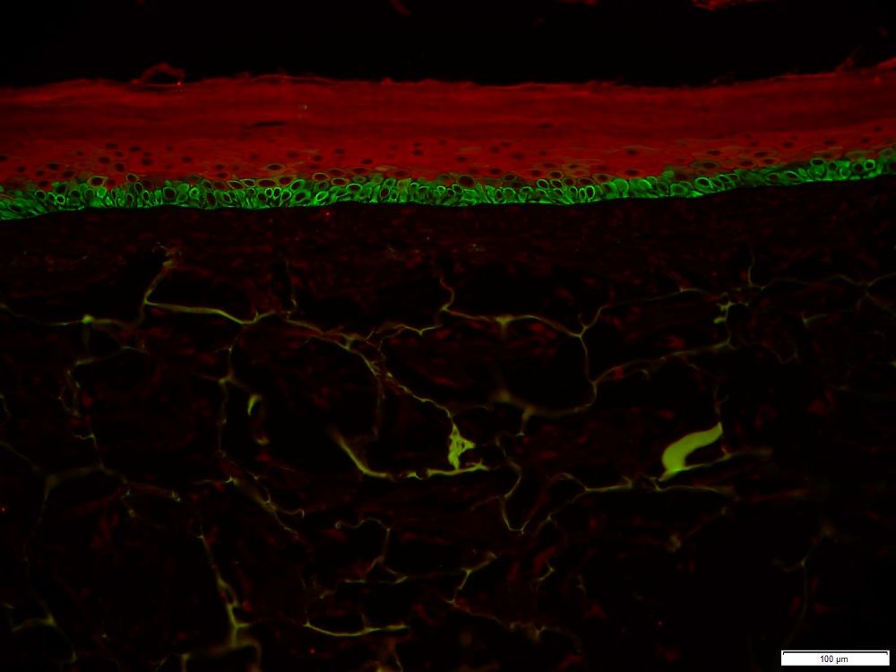 Reconstructed Tissues
