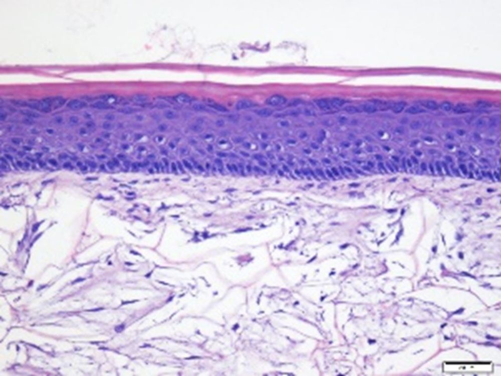 Reconstructed Tissues